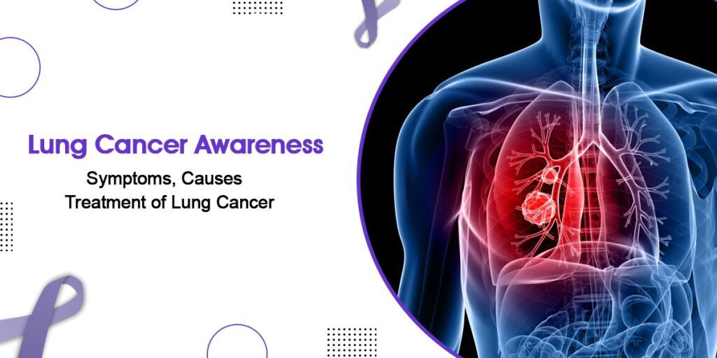 Main Symptoms Causes And Treatment Of Lung Cancer Canceronco