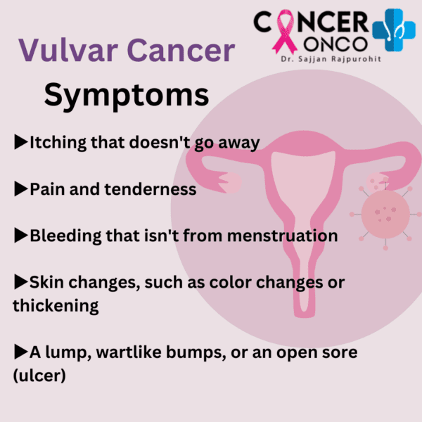 Vulvar Cancer: Main Symptoms, Causes, and Treatment Options